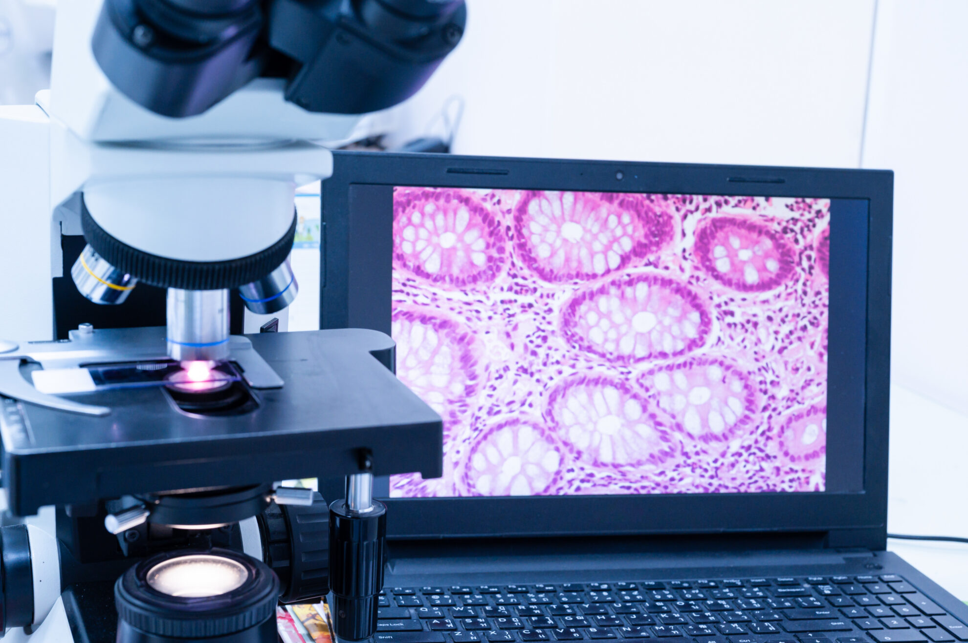 Order FFPE Sections, Slides, & Blocks | Superior BioDx